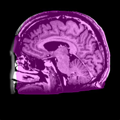 Dl Model Inference Pipeline — Pyradise 023 Documentation