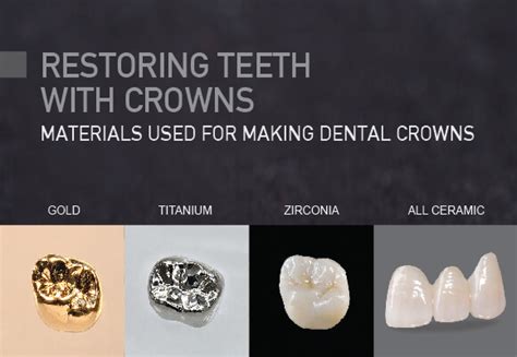 Types Of Dental Crowns