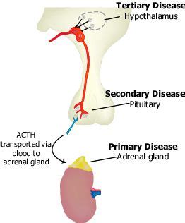 Clearly Alive Icymi Primary Vs Secondary Vs Tertiary Adrenal