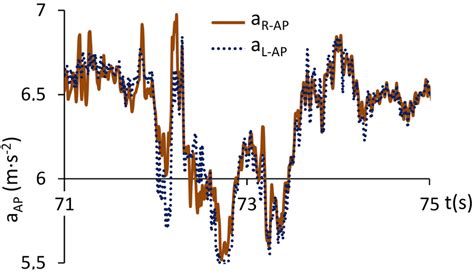 Linear Accelerations Chart A In The Anterior Posterior Ap Direction