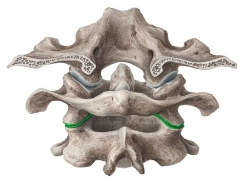 Atlanto Axial Joint Wikism Sports Medicine Wiki