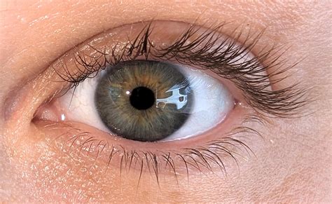 Heterochromia Gray And Brown Understanding Eye Color Variations
