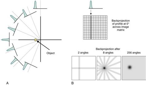 Tomographic Reconstruction In Nuclear Medicine Radiology Key