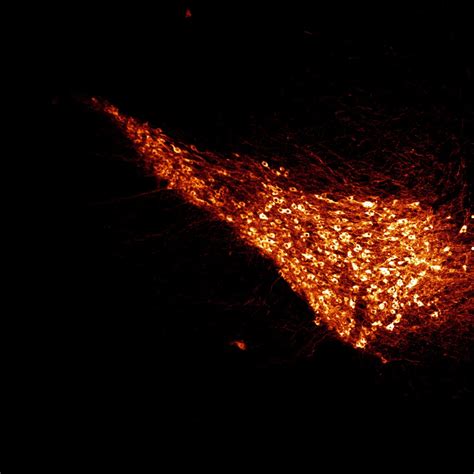 Effects Of Stress On Dopamine Circuit Structure And Function Lerner Lab Northwestern