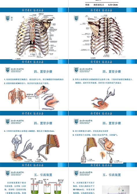 胸腔闭式引流术ppt课件卡卡办公