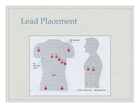 Solution Powerpoint Presentation Of The Basics Of Ekgs From R Gentry Wilkerson Uploaded 2015