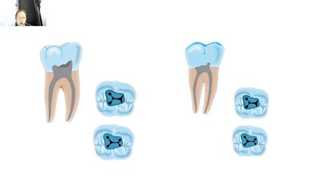 Эрүүний шүдний хөндийн байршил онцлог Youtube