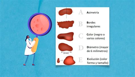 Día Mundial Del Melanoma Concienciación Y Prevención Eticos Paraguay