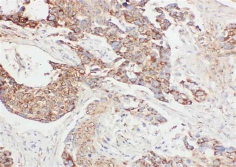 Pee14 4 Plasmid Pee14 4 Pee14 4 Plasmid Pee14 4 Sequence Pee14 4 Map