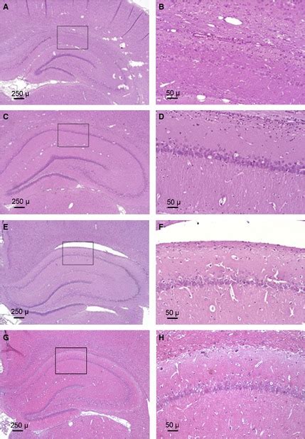 Photomicrographs Of Paraffin Embedded Brain Sections Stained With