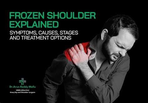Frozen Shoulder Symptoms Causes Stages And Best Treatment Options