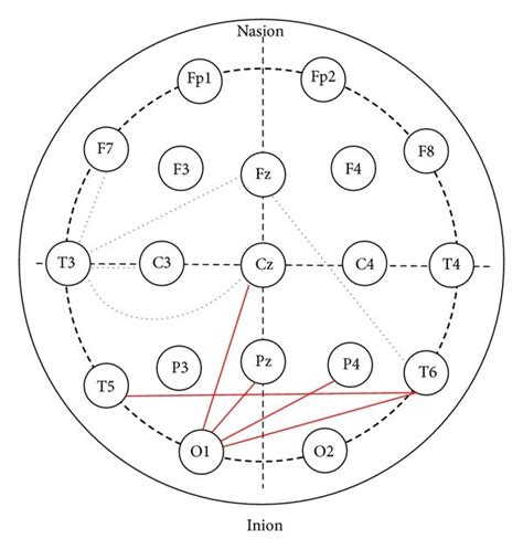 Variations Of Interregional EEG Correlations A Is In The Measurement Download Scientific