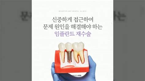 동래치과임플란트 성공률을 높이기 위해 네이버 블로그