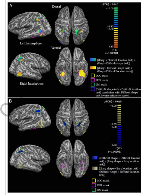 A Cortical Statistical Maps As Revealed By The Rfx Contrasts Easy