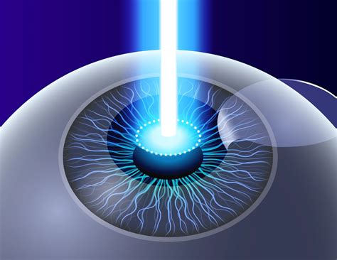 Apakah Lasik Bisa Pakai Bpjs Ini Penjelasan Sistemnya Jec Eye Hospitals And Clinics Best Eye