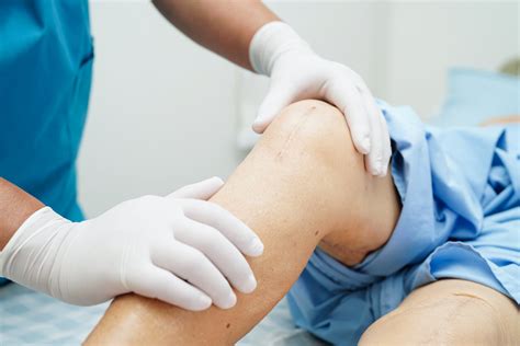 Lifestyle Adjustments After Knee Replacement Whats Different