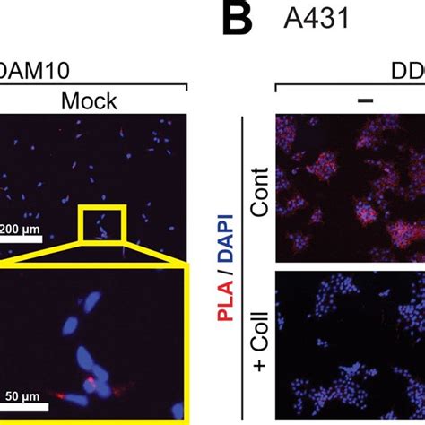 The Sheddase Responsible For Collagen Induced Ddr1 Shedding Is