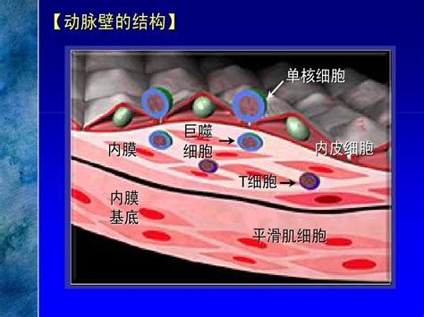 动脉粥样硬化 Word文档在线阅读与下载 无忧文档