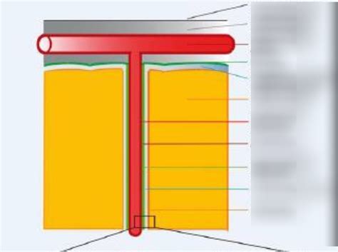 Virchow Robin Raum Diagram Quizlet