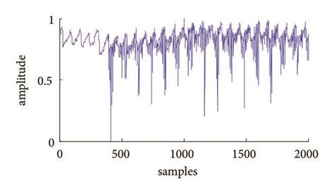 Spectral Analysis Of The Reflected Ppg Signal Before And After