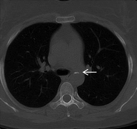 Chest Computed Tomography Download Scientific Diagram