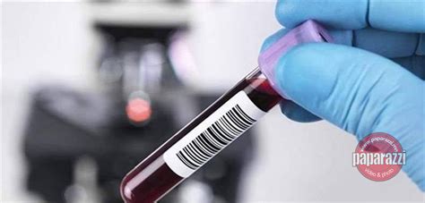 Өнгөрсөн оны мөн үетэй харьцуулахад тэмбүүгээр өвчилсөн өвчтөний тоо 154 тохиолдлоор их байна