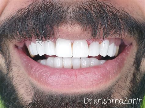 👩‍⚕️🦷 بۆ چارەسەر ،جوانکاری و Dr Krishma Dhahir