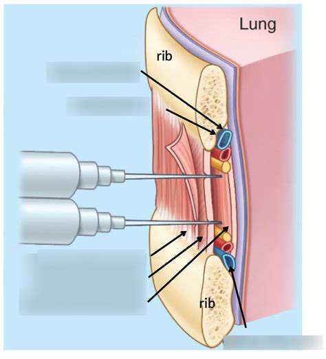 Diagram Of Intercostal Neurovascular Supply Labelling Quizlet
