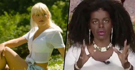 Model Who Took Melanin Injections Says She Hasnt Experienced Racism