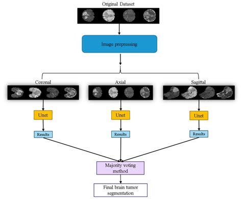 brain tumor segmentation using u net in conjunction with efficientnet