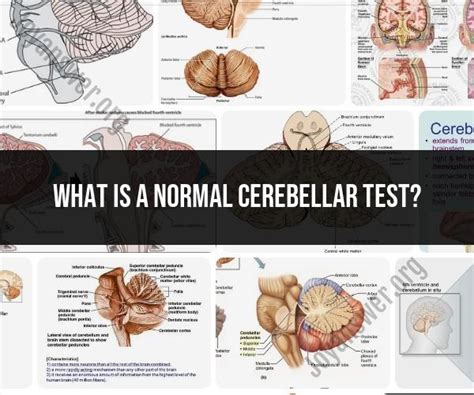 Understanding A Normal Cerebellar Test Insights And Significance