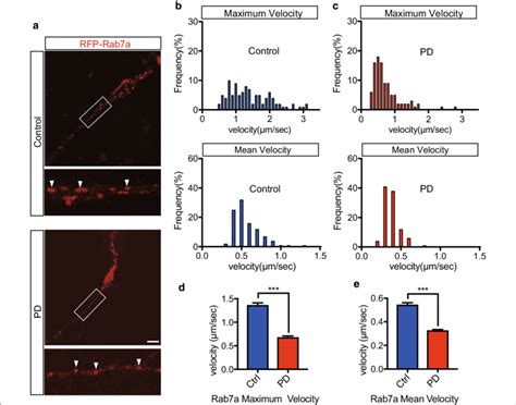 Vps35 Mutation Affects The Movement Of Late Endosomes A Ipsc Derived Download Scientific