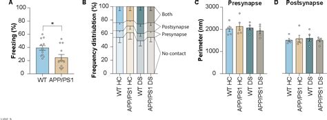 Figure 1 From Electron Microscopy Analysis Of Astrocyte Synapse Interactions Shows Altered
