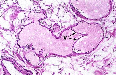 Histology Of Immune System Lymph Nodes Thymus Spleen Flashcards Quizlet