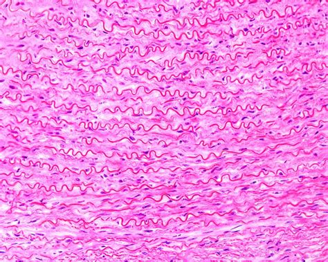 Aorta Light Micrograph Stock Image C0361269 Science Photo Library