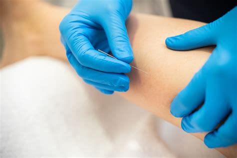 Dry Needling Vs Acupuncture Main Differences And Similarities
