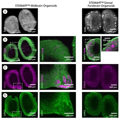 STEMdiff Midbrain Organoid Differentiation Kit STEMCELL Technologies