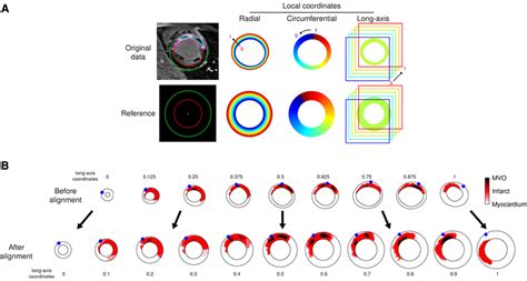Data Alignment Steps Illustrated On The Representative Patient From Download Scientific Diagram