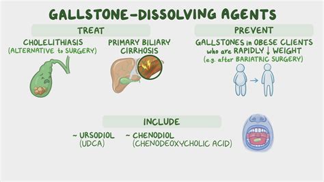 Gallbladder Disorders Pathology Review Video Osmosis 47 Off