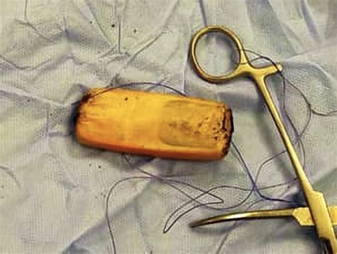 The Forbidden Fish Stick Rforbiddensnacks