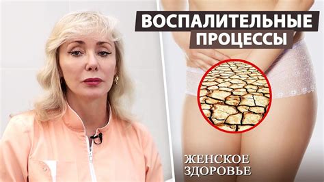 Сухость в интимной зоне: причины и лечение - YouTube