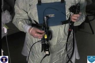 Cholangioscopy Abdominal Key