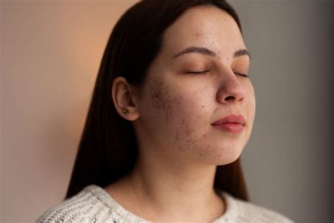 Skin Diseases Symptoms Causes Diagnoses And Treatments