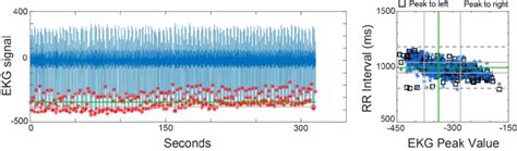 Graphical Output Produced By EEG Beats Left EKG Signal Acquired Using Download Scientific