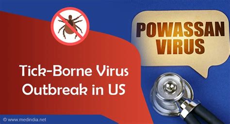 Powassan Virus Disease Explained