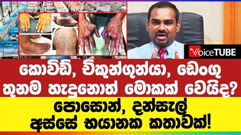 කොවිඩ් චිකුන්ගුන්යා ඩෙංගු තුනම හැදුනොත් මොකක් වෙයිද පොසොන් දන්සැල් අස්සේ භයානක කතාවක් Youtube