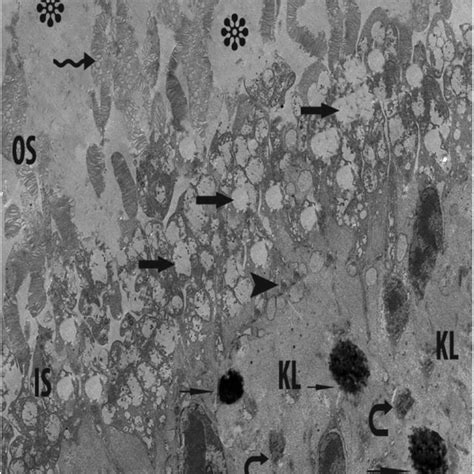 Electron Micrograph Of The Photoreceptor Layer In Reperfusion Group Download Scientific