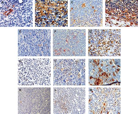 Cell Type Specific Expression Of Selected Gene Products Revealed By