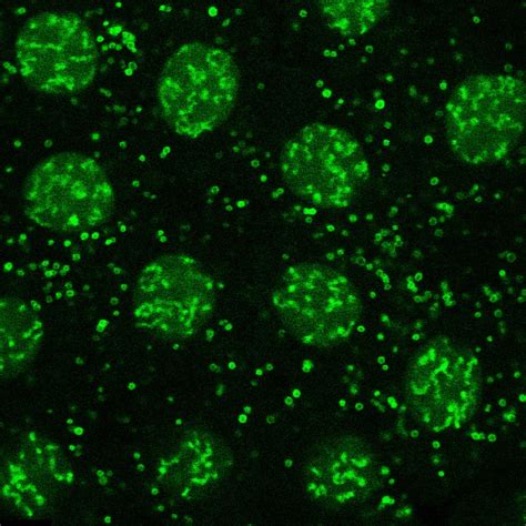 Lipid Droplets Play Crucial Roles Beyond Fat Storage Newscenter