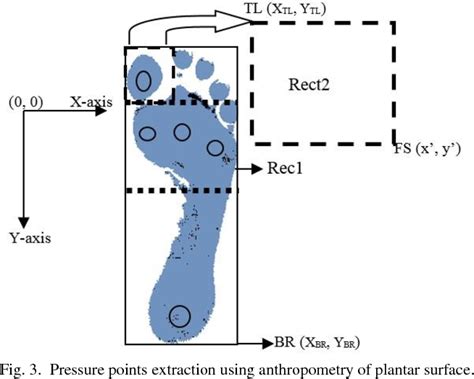 Figure 3 From Automated Peripheral Neuropathy Assessment Using Optical Imaging And Foot
